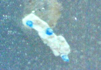Morgellons Photos ~ Oddities and Ends