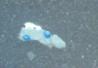 Morgellons Photos ~ Oddities and Ends