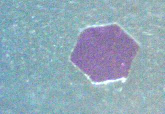 Morgellons Photos ~ Oddities and Ends