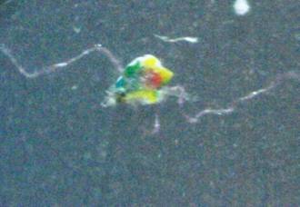 Morgellons Photos ~ Oddities and Ends