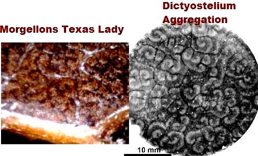 Morgellons - The Throwback Collection