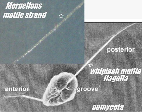 Morgellons - The Throwback Collection